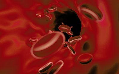 Transformational change: blood component waste